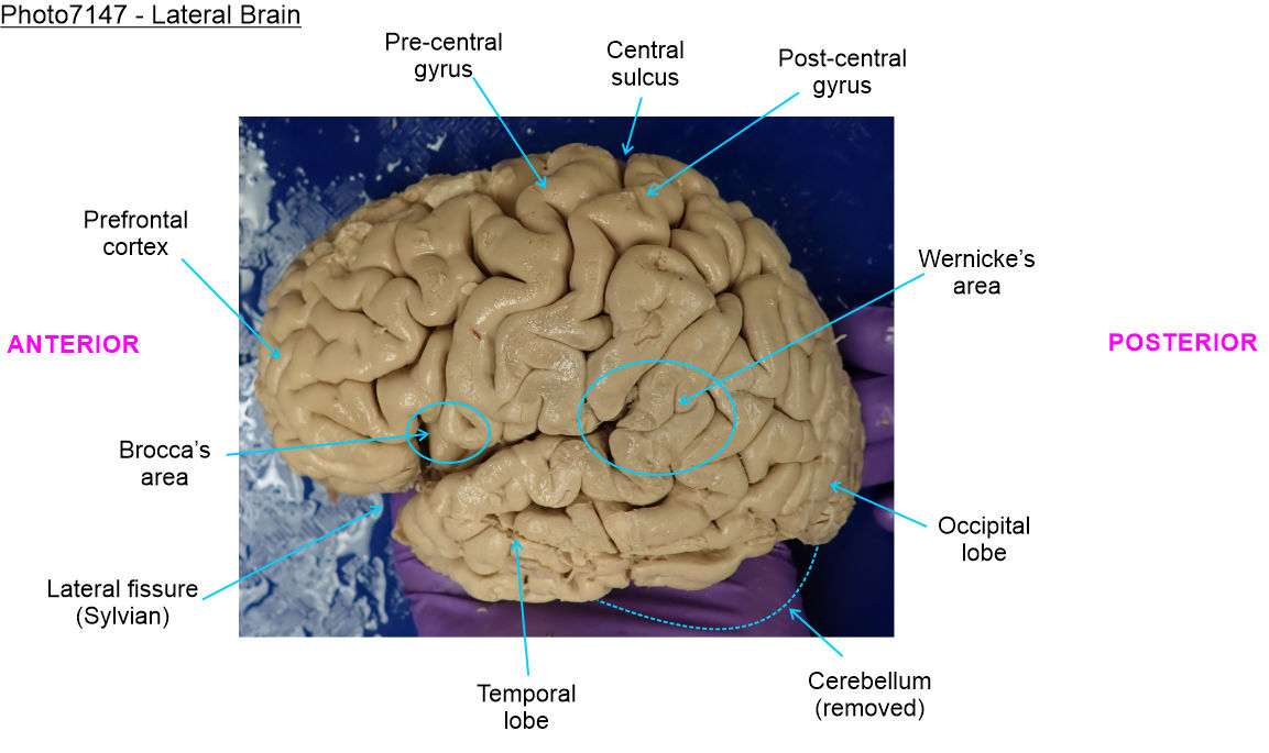Posterior Anterior Brain